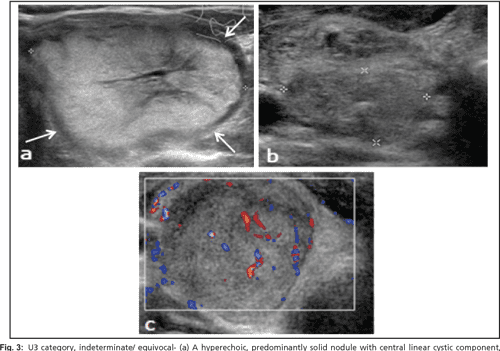 Figure 1 from Reliability of the ultrasound classification system of ...