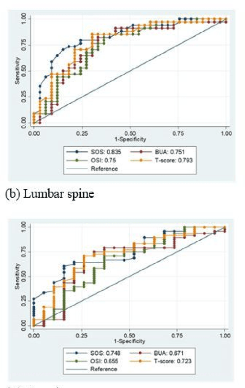 [PDF] Comparison Between Calcaneus Quantitative Ultrasound and the Gold ...