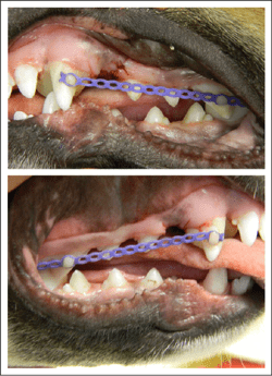 Figure 42 from Management of Mesioverted Maxillary Canine Teeth and ...