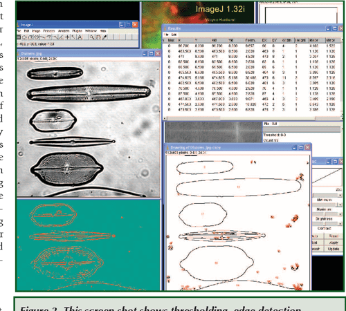 Tute1 Basic Image Processing With Imagej Youtube