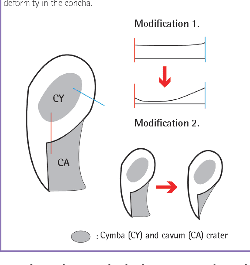 Figure 1 from The Importance of a Conchal Bowl Element in the ...