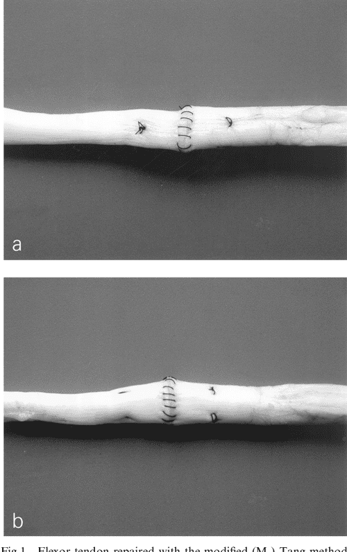 Table 2 from Biomechanical Analysis of a Modification of Tang Method of ...
