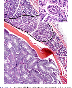 Figure 1 from Scrotal stalk ablation and orchiectomy using ...