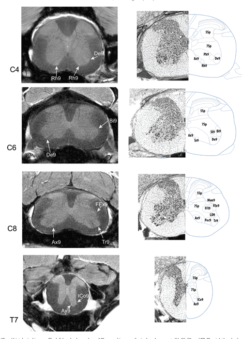 [PDF] Vertebral landmarks for the identification of spinal cord ...