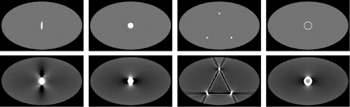 [PDF] CT artifacts: Causes and reduction techniques | Semantic Scholar