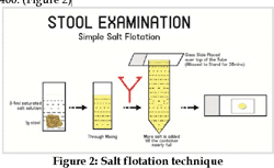Comparison of Routine and Concentration Techniques on Microscopic ...