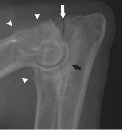 Figure 3 from Diagnostic imaging of canine elbow dysplasia: a review ...