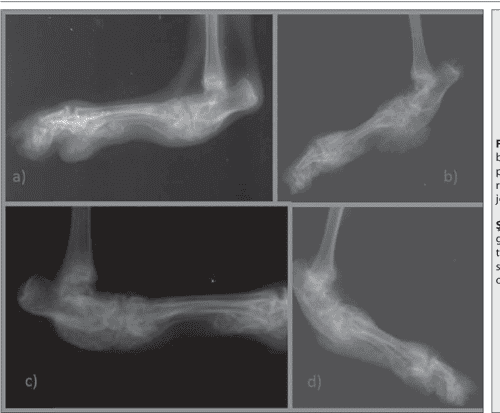 Figure 8 from Hereditary osteochondrodysplasia in Scottish Fold cats ...