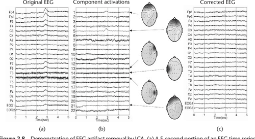 Figure 1.1 from Quantitative EEG analysis methods and clinical ...