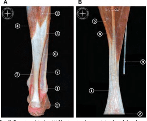 Figure 13 from Anatomy of the triceps surae: a pictorial essay ...