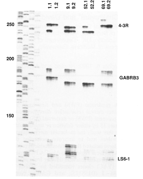 Figure 1 from Multiplex PCR of three dinucleotide repeats in the Prader ...