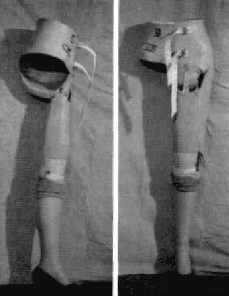 Figure 4 from Some experience with the Canadian-type hip ...