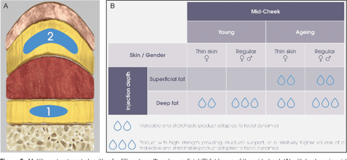 [PDF] Injection Guidelines for Treating Midface Volume Deficiency With ...