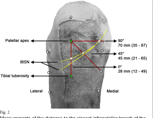 The surgical anatomy of the infrapatellar branch of the saphenous nerve ...