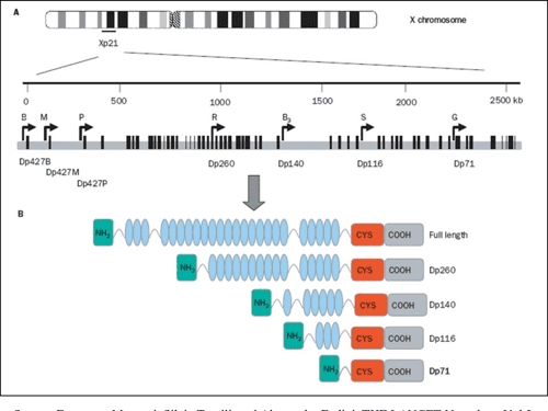 Figure 5 from Spectrum of mutations in Duchenne Muscular Dystrophy (DMD ...