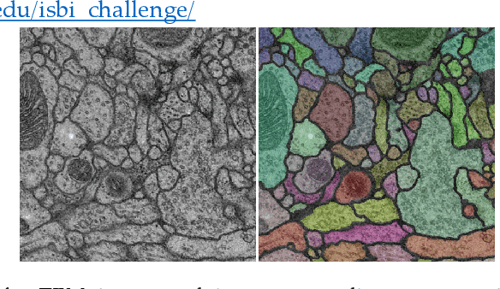 Pdf U Net And Its Variants For Medical Image Segmentation A Review Of Theory And Applications
