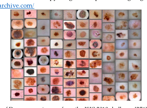 Pdf U Net And Its Variants For Medical Image Segmentation A Review Of Theory And Applications