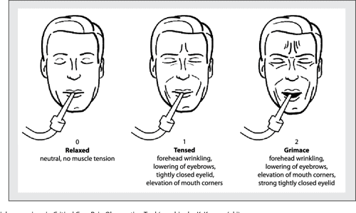 [PDF] Methods of pain assessment in adult intensive care unit patients ...