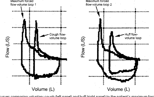 Table 4 from Forced expiratory technique, directed cough, and autogenic ...