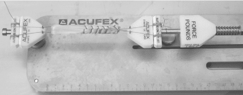 ACL Graft Fixation : Interference Screw Fixation of the Soft Tissue ...