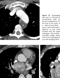 Figure 1 from ITMIG Classification of Mediastinal Compartments and ...