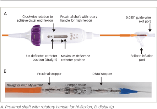 Figure 3 from The Myval Transcatheter Heart Valve System for the ...