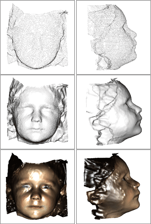 Figure 1.1 from Curve extraction and facial analysis using statistical ...