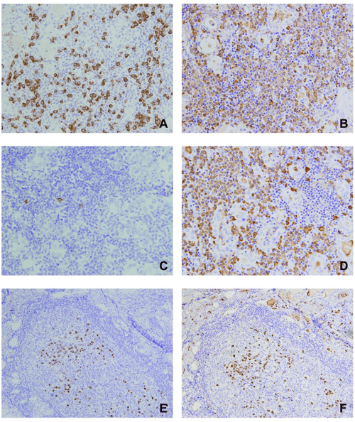 Figure 1 from A classification of Hashimoto's thyroiditis based on ...