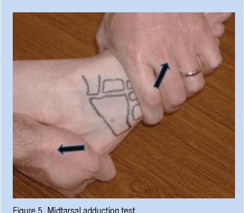 Figure 2 from Examination and Treatment of Cuboid Syndrome | Semantic ...
