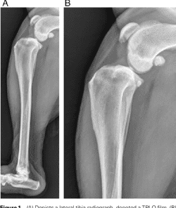 Figure 1 from Radiographic quantitative assessment of caudal proximal ...