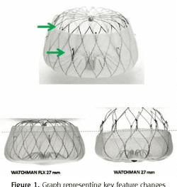 Figure 1 from The Watchman FLX – a new device for left atrial appendage ...