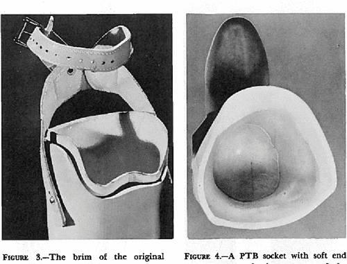 Figure 1 from Variants of the PTB (patellar-tendon-bearing) below-knee ...