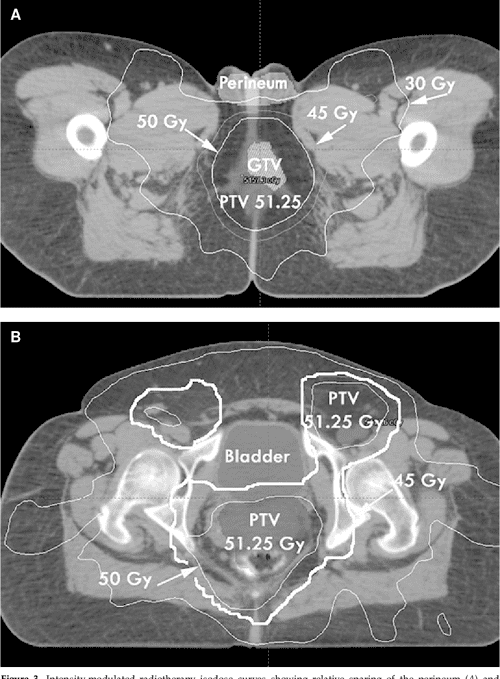 Figure 1 from Case report from Mayo Clinic: Locally advanced Bartholin ...