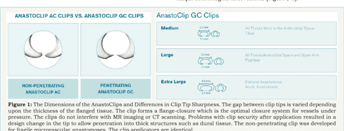 Figure 2 from Applications of the AnastoClip® for Neurosurgical ...