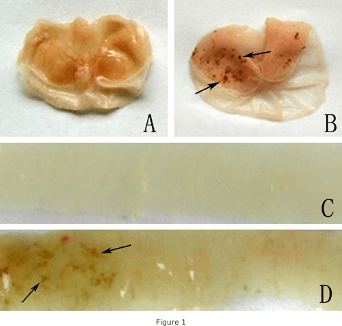 [PDF] New Mechanisms of Gastrointestinal Mucosal Injury and Bleeding ...