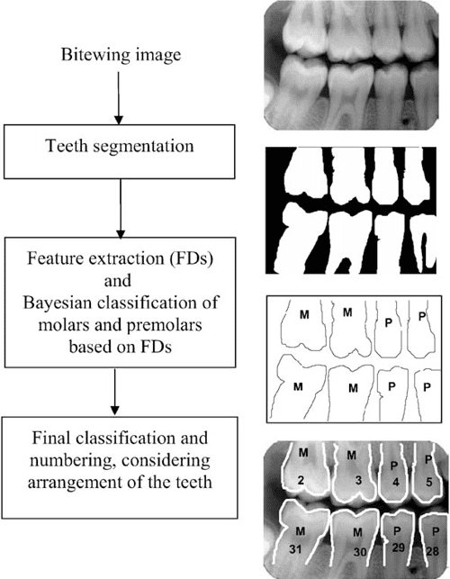 Table 2 from Classification and numbering of teeth in dental bitewing ...