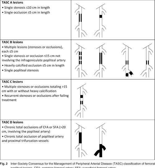 [PDF] An Update on Methods for Revascularization and Expansion of the ...