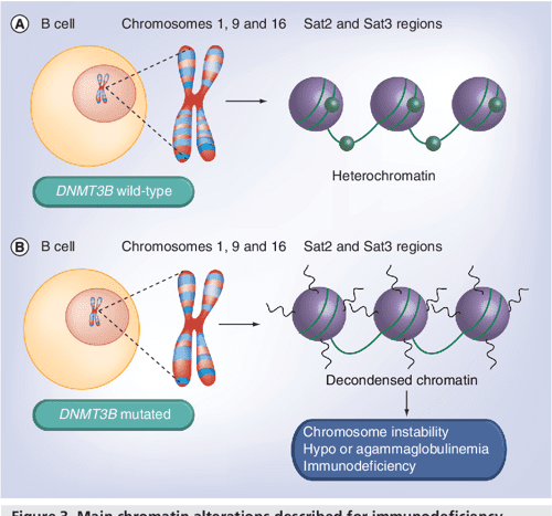 Figure 1 from Epigenetic Mechanisms in two primary immunodeficiencies ...