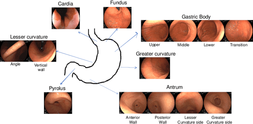 Labelling Stomach Anatomical Locations In Upper Gastrointestinal ...