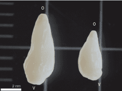 Figure 2 from First Record of Paramphistomes Fischoederius cobboldi and ...