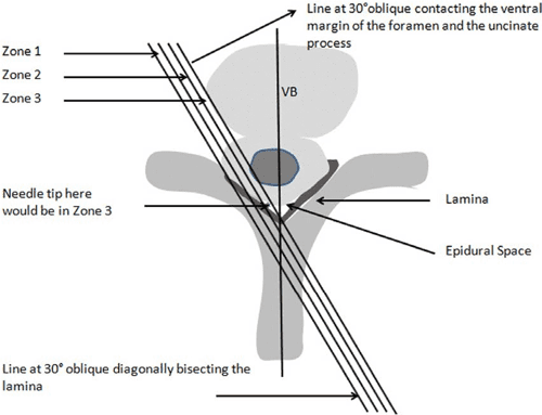 [PDF] Contralateral oblique view is superior to lateral view for ...