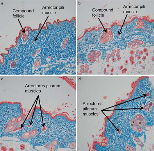 Figure 3 from The Role of Piloerection in Primate Thermoregulation ...