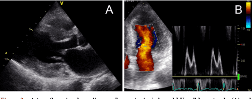 Figure 2 from The Imaging Diagnosis of Less Advanced Cases of Cardiac ...