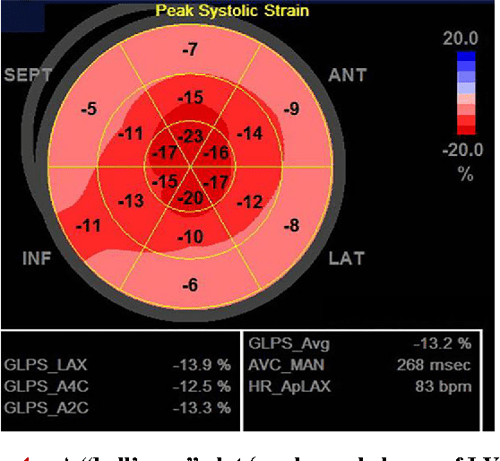 Figure 2 from The Imaging Diagnosis of Less Advanced Cases of Cardiac ...