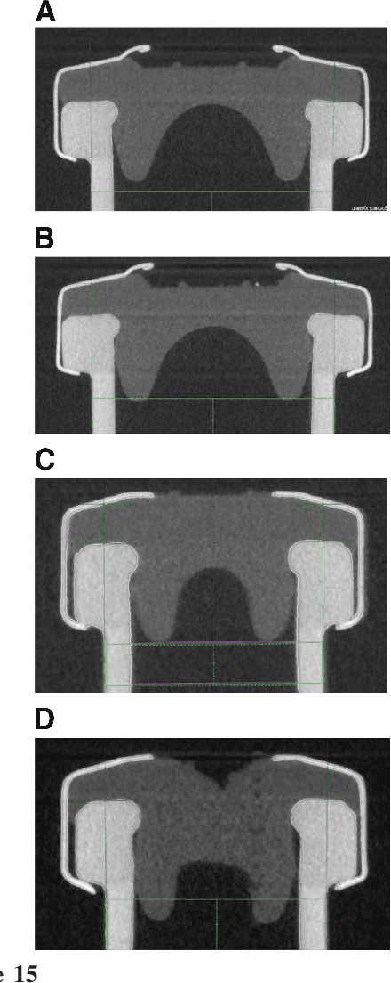 Figure 1 from Impact of Vial Capping on Residual Seal Force and ...
