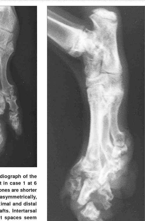 Figure 7 from Osteochondrodysplasia in Scottish Fold cats | Semantic ...
