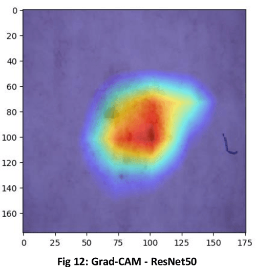 Figure 1 from Classification of Skin Cancer Images using Convolutional ...
