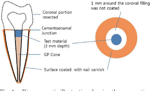 In Vitro Microleakage Of Six Different Dental Materials As Intraorifice Barriers In