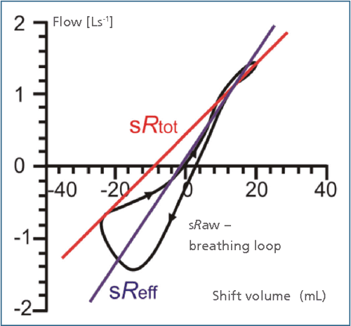 Figure 1 from R-V graph in whole body plethysmography | Semantic Scholar