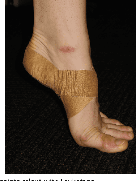 Figure 4 from Foot and ankle problems in dancers. | Semantic Scholar
